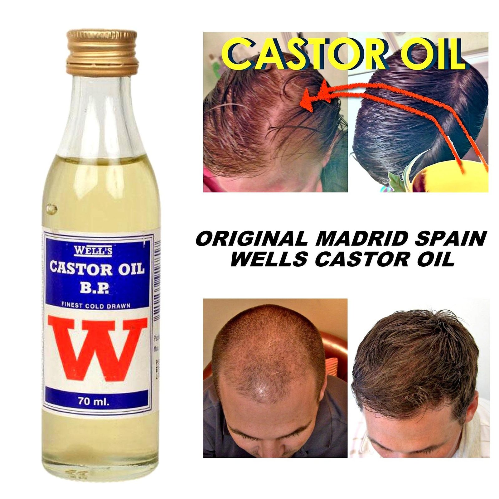 Wells Castor Oil 70ml – Well Being
